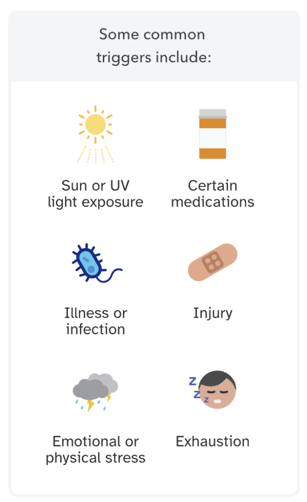 Is Lupus Genetic? Genetic Testing for Lupus - 23andMe